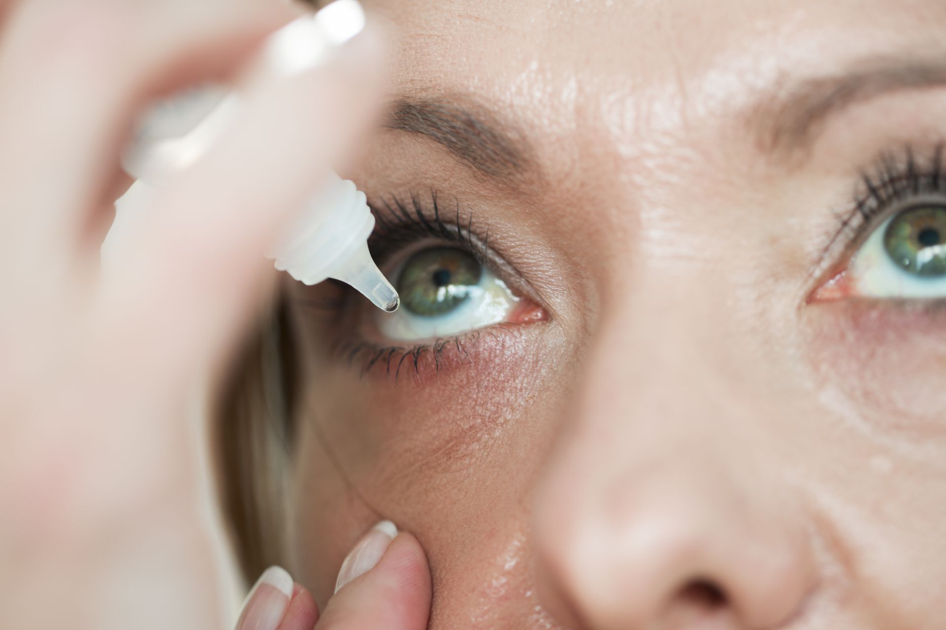 4 tratamientos naturales para eliminar la carnosidad en los ojos de ...