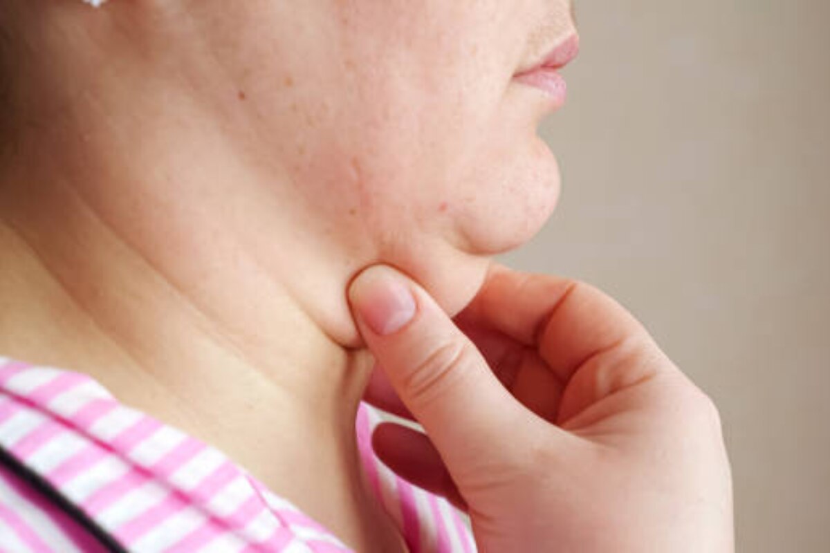 ¡Descubre por qué se forma la papada y cómo deshacerte de ella de ...