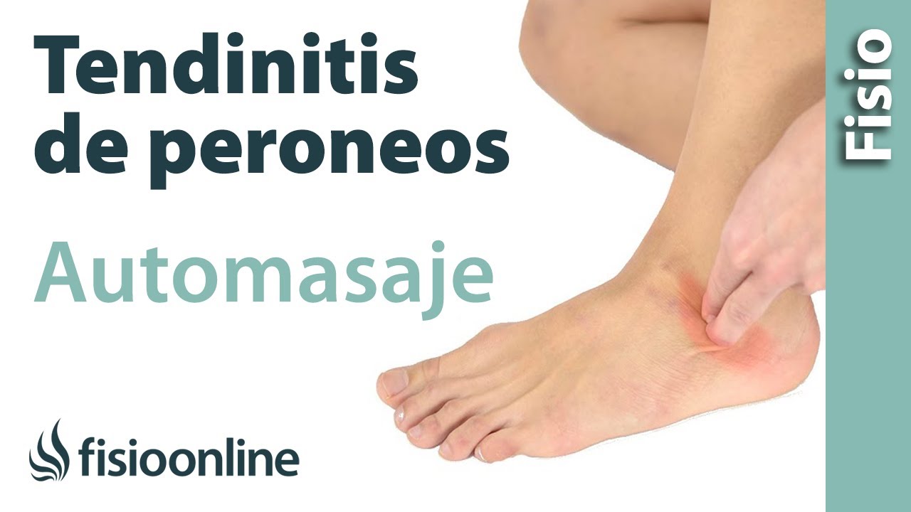 Tendinitis en el pie: Descubre cómo prevenirla y aliviar el dolor de ...